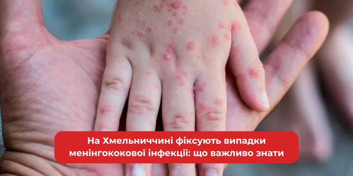 На Хмельниччині фіксують випадки менінгококової інфекції: що важливо знати - vsim.ua